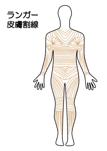 刺創と皮膚割線の関係 - 法医学ブログ